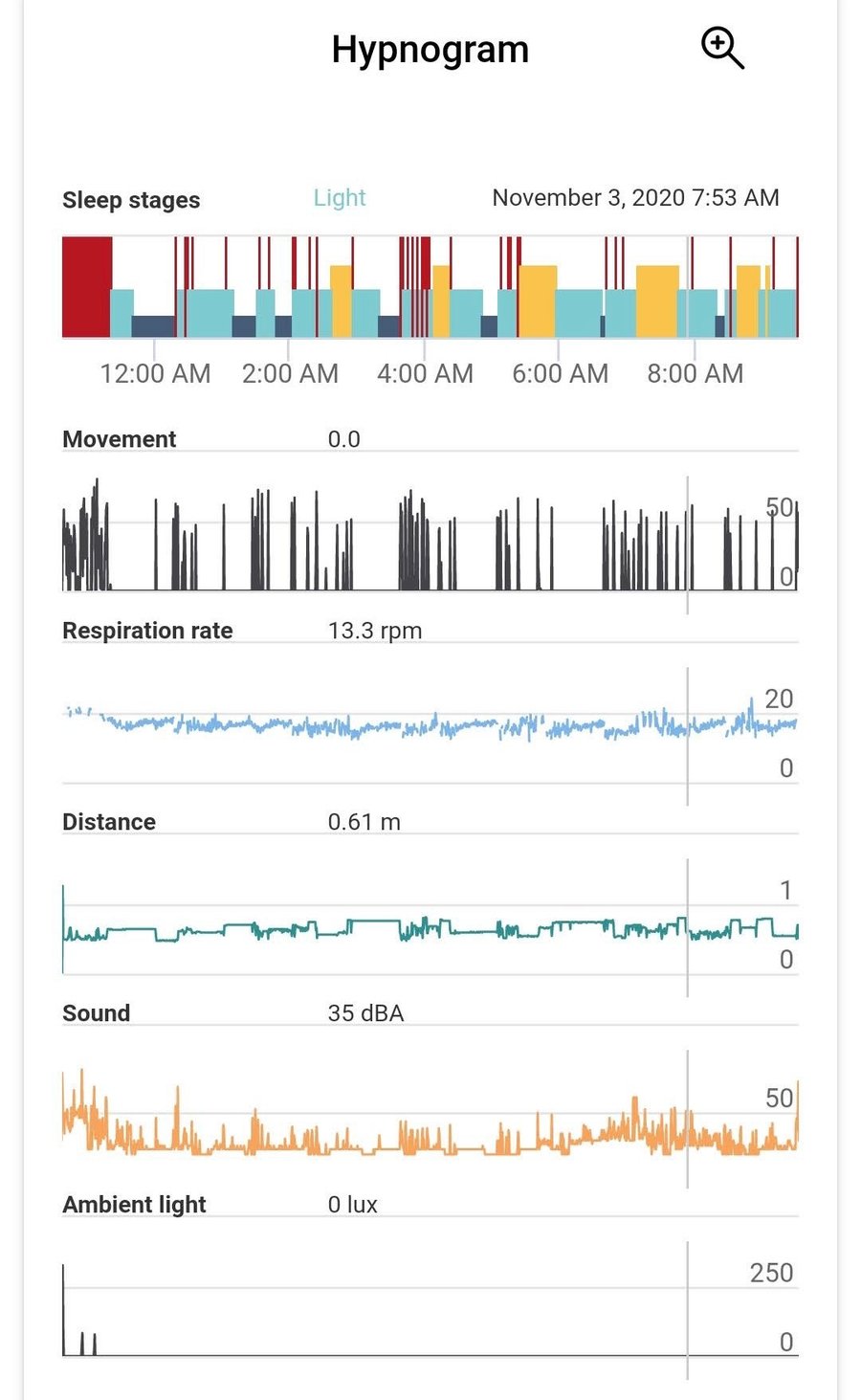 How to interpret Sleep Score and Hypnogram