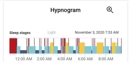 How to interpret Sleep Score and Hypnogram