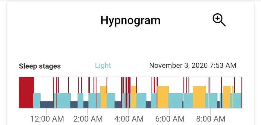 How to interpret Sleep Score and Hypnogram